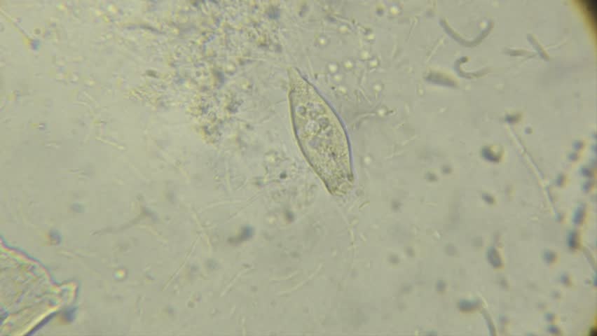 Stock video of stentor ciliate microorganism contracting into a ...