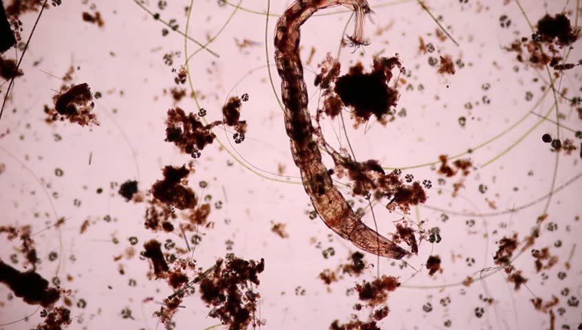 Annelida Stock Video Footage - 4K and HD Video Clips | Shutterstock