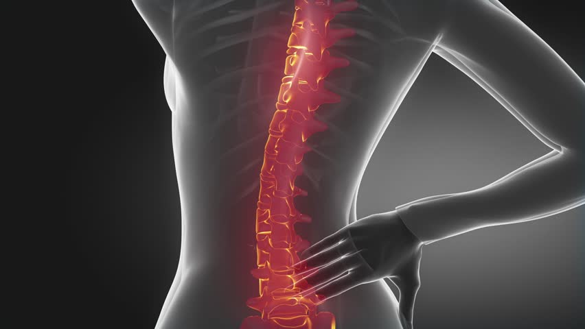Female Backbone Hurt Injury - Spine Concept Stock Footage Video ...