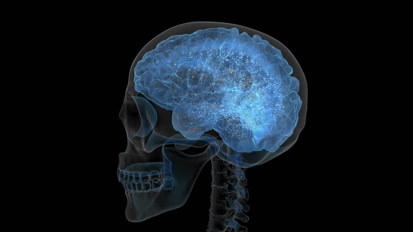 X-ray Of Human Skull With Brain Being Covered With Artificial Network ...