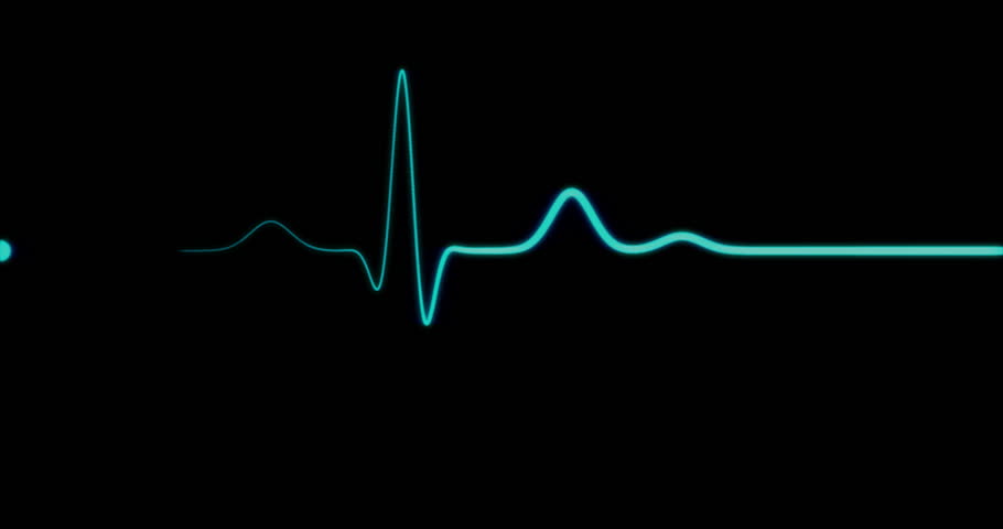 Animation Of Schematic Diagram Of Normal Sinus Rhythm For A Human Heart ...