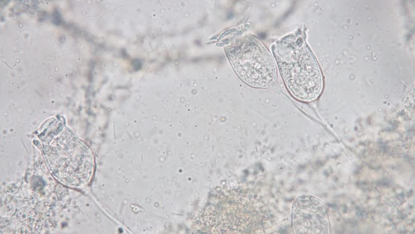 Living Vorticella Is A Genus Of Protozoan Under Microscope View. Stock ...
