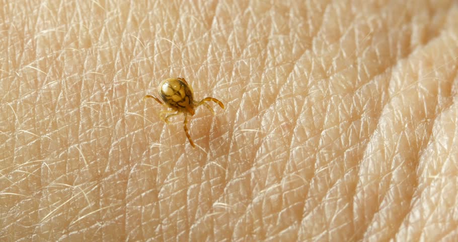 Paralysis Ticks, Also Called Dog Ticks, Shell-back Ticks Or Scrub Ticks ...