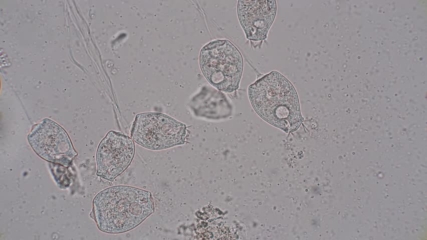 Spathidium Feeding On Motile Spirilla Bacteria. A Good View Of The ...