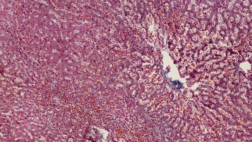 Liver - Human Body Cells Stock Footage Video (100% Royalty-free ...