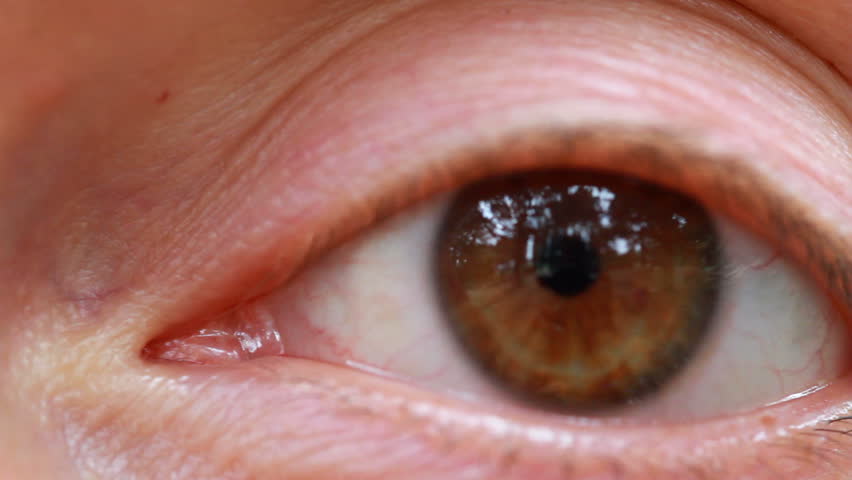 Syphilis In The Eye