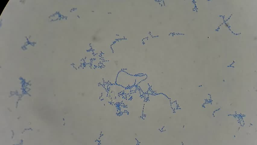 Full Hd. Bacteria Streptococcus Pyogenes Stock Footage Video (100% ...