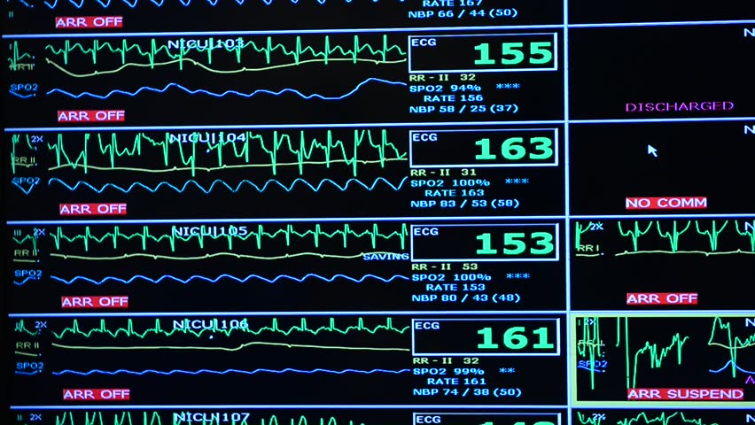 Patient's Revival, ICU Monitor With Vital Signs Rising After Cardiac ...