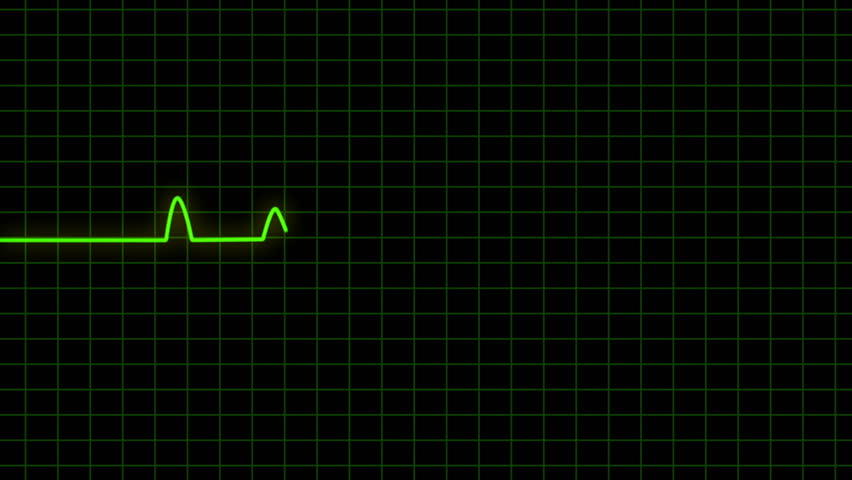 Flatline Stock Footage Video | Shutterstock
