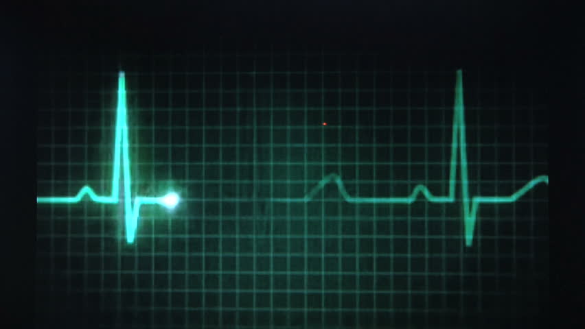 Flatline Stock Footage Video | Shutterstock