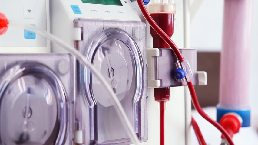 Arlificial Kidney (dialysis) Medical Device With Rotating Pumps Stock ...